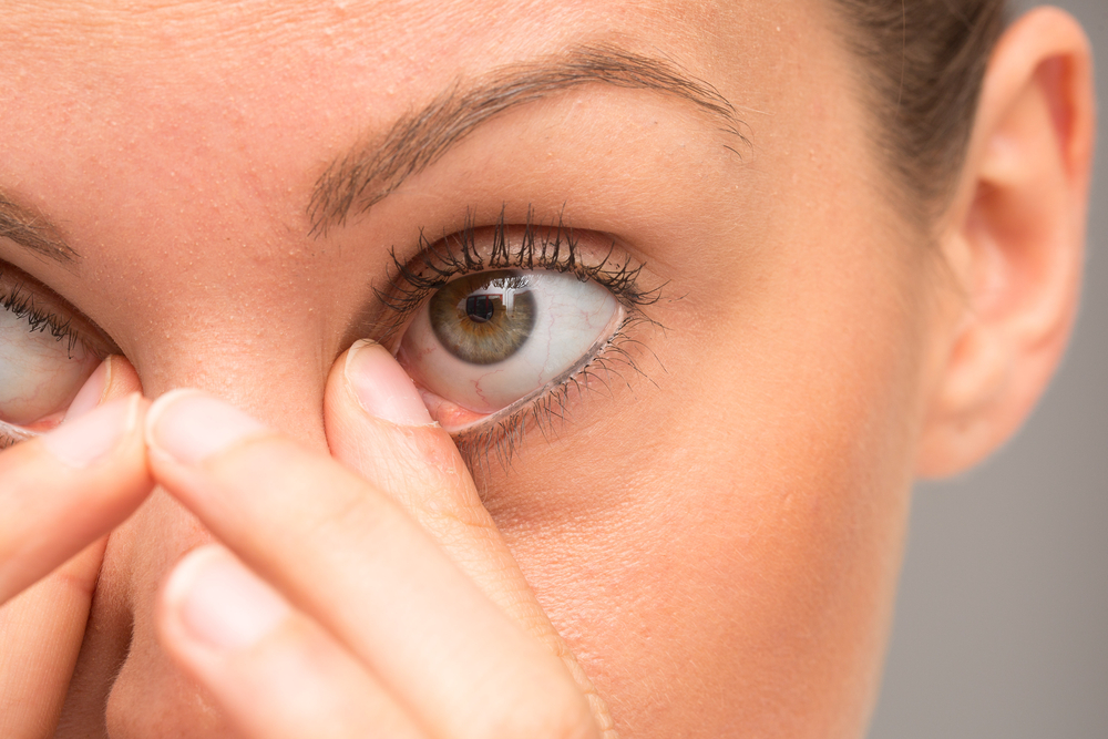 Augen lasern » Kosten und Preisbeispiel im Überblick