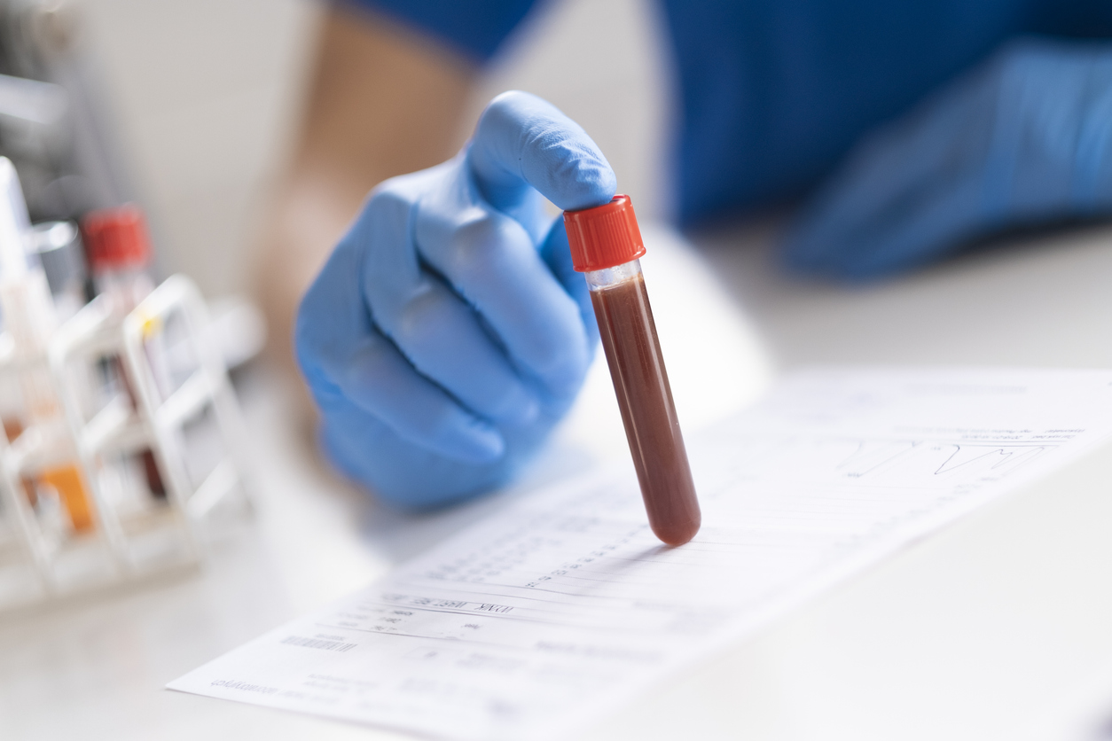 Toxoplasmose Test » Mit diesen Kosten müssen Sie rechnen